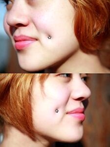 Dimple Piercing : Positions, Risks and Aftercare